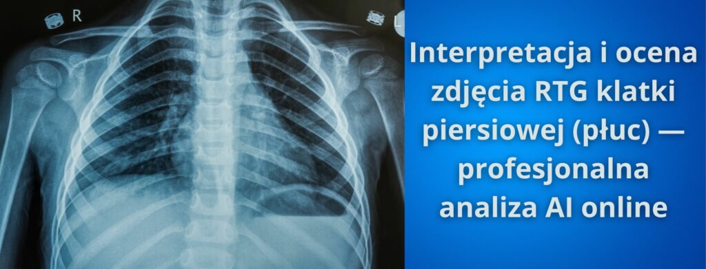 Interpretacja i ocena zdjęcia RTG klatki piersiowej (płuc ...